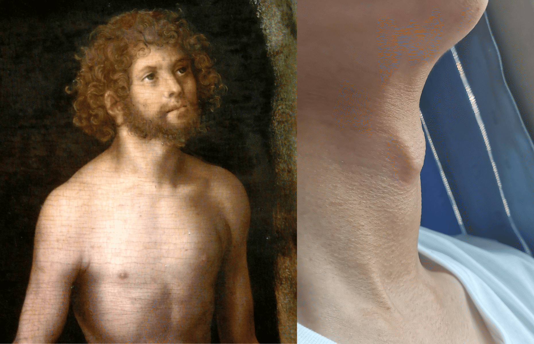 20 body parts named after people - Espresso Mag